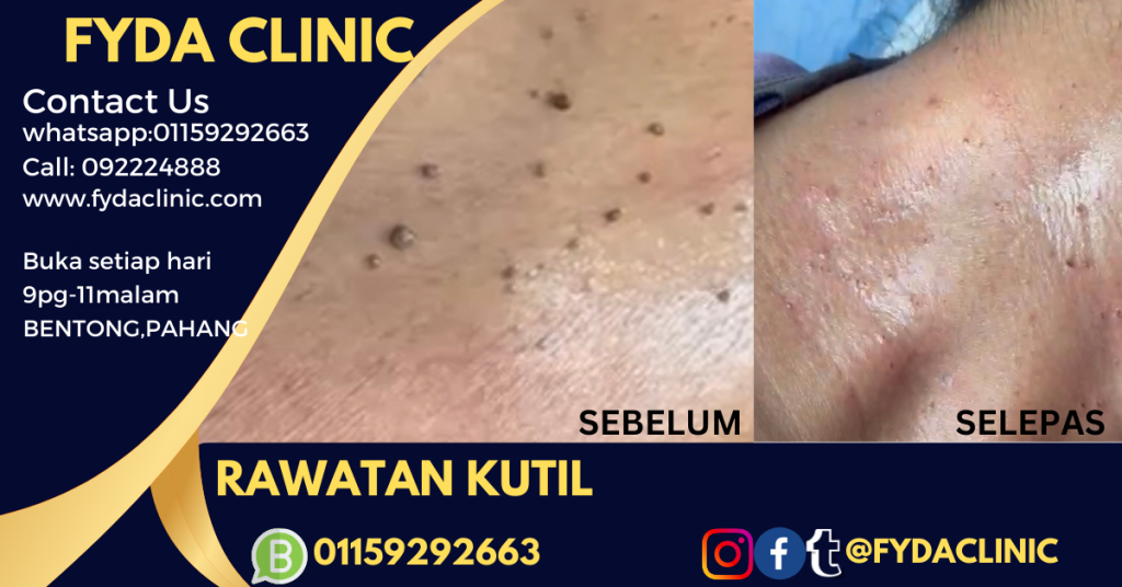 Skin Treatment – Fyda Clinic